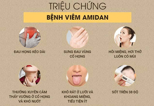 Bệnh viêm Amidan: Triệu chứng và những điều cần biết